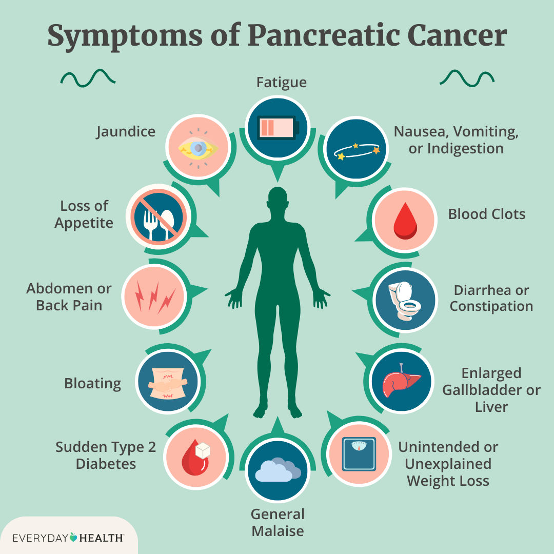 Understanding the Warning Signs of Pancreatic Cancer - 𝕋𝕖𝕔𝕙𝕟𝕖𝕨𝕤𝕚𝕟𝕗𝕠𝕠